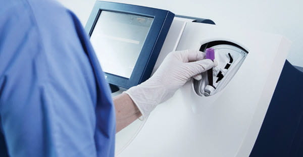 Analizador de inmunoensayo AQT90 FLEX de Radiometer